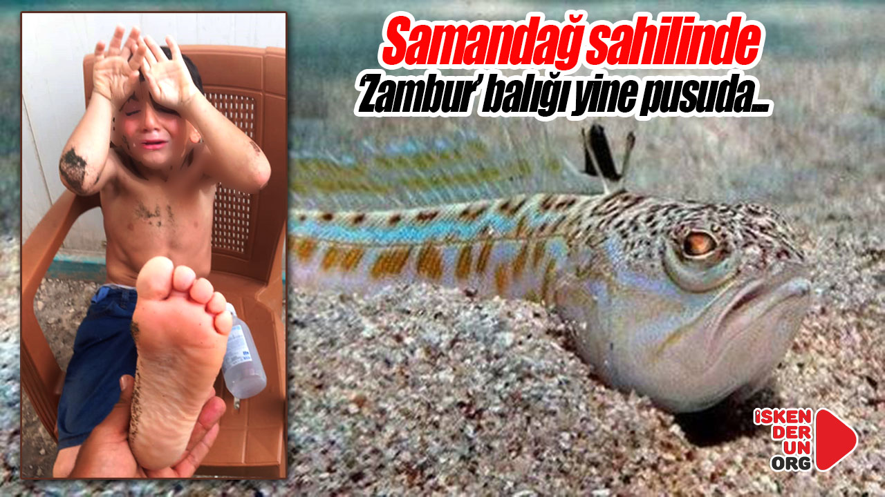 Samandağ ‘Zambur’ balığı can yakmaya başladı... - iskenderun